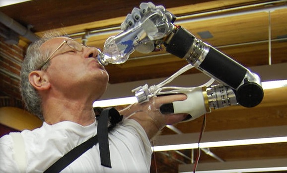 Bionic DEKA Arm, mind-controlled prosthetic, approved by FDA ‹ News ...